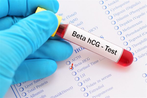 هورمون بتا HCG چیست و چه کاربردهایی می تواند داشته باشد - اوج آزما پلاست